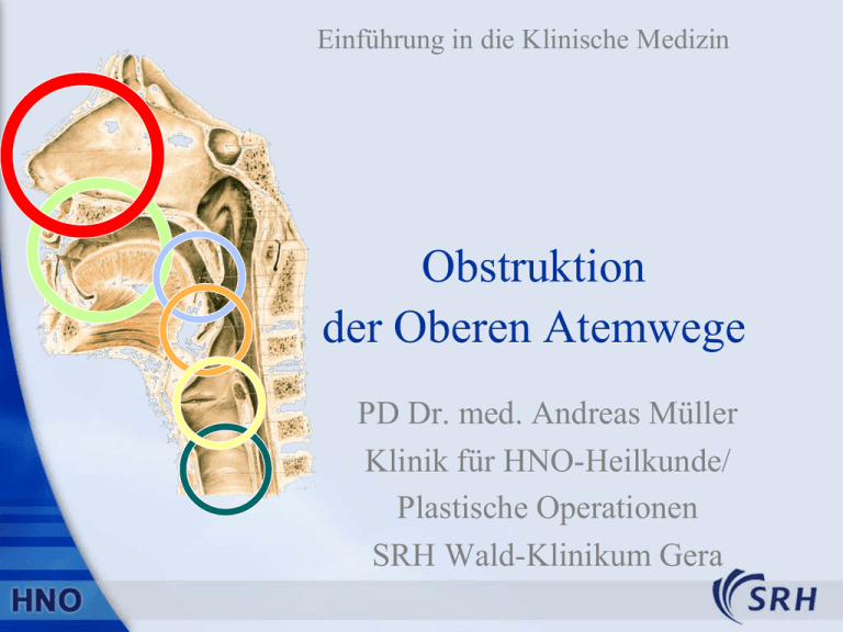 Obstruktion der Oberen Atemwege